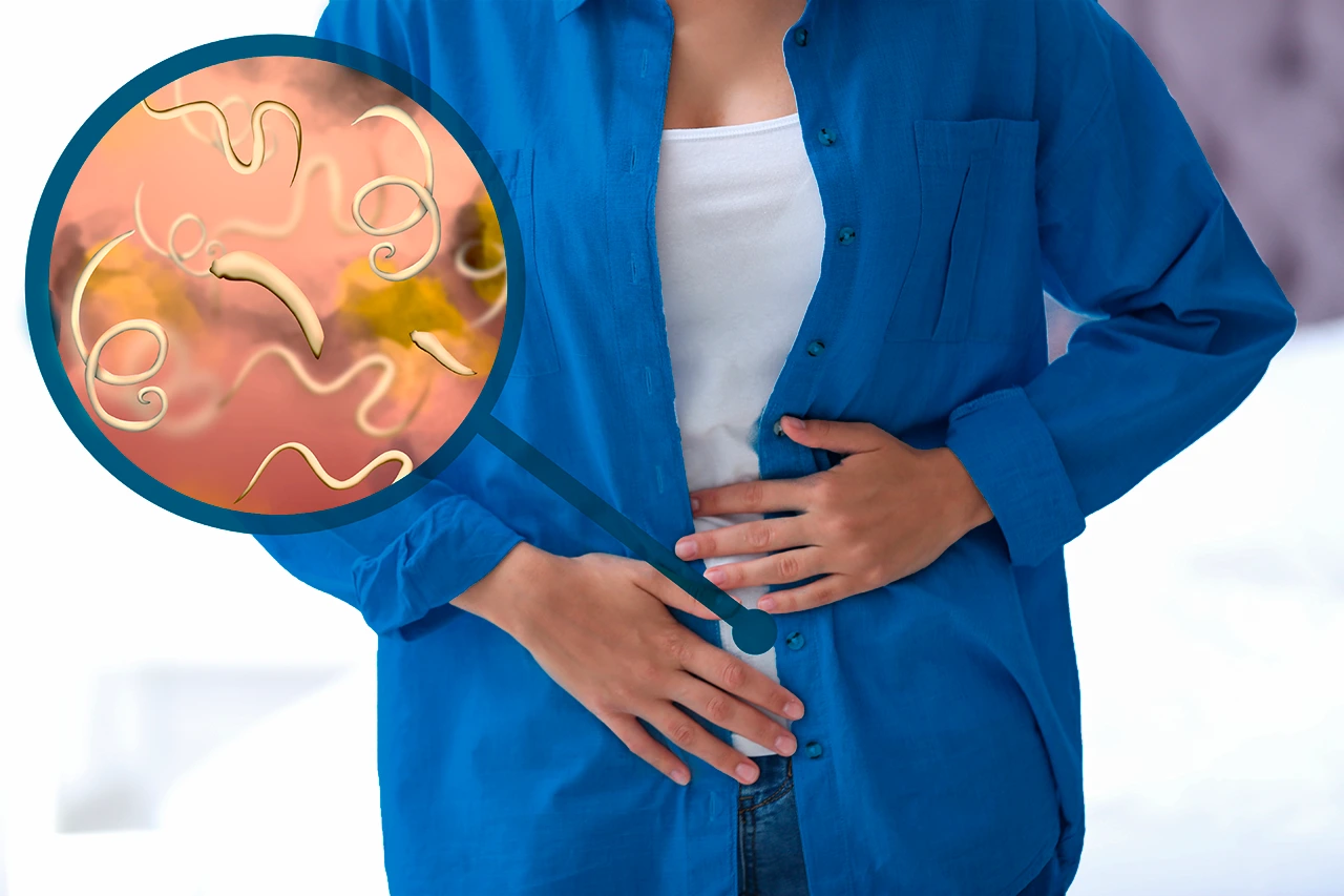 Parásitos intestinales | Centro Médico ABC