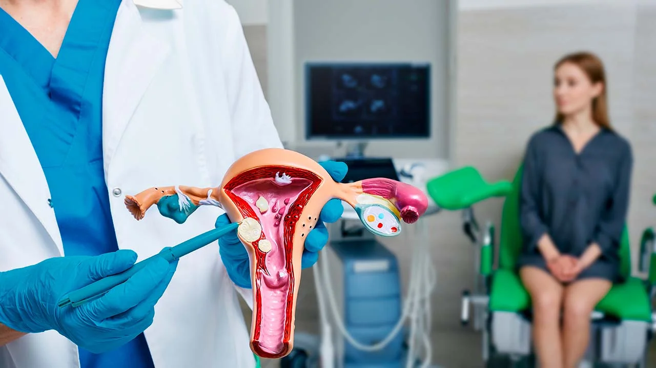 Qué es un mioma | Centro Médico ABC