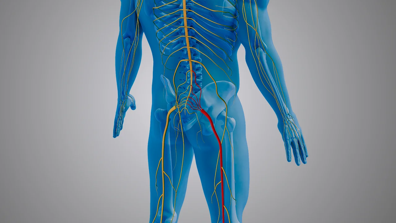 L 5 Dolor Del Nervio Cuánto Tarda En Desaparecer La Ciática?