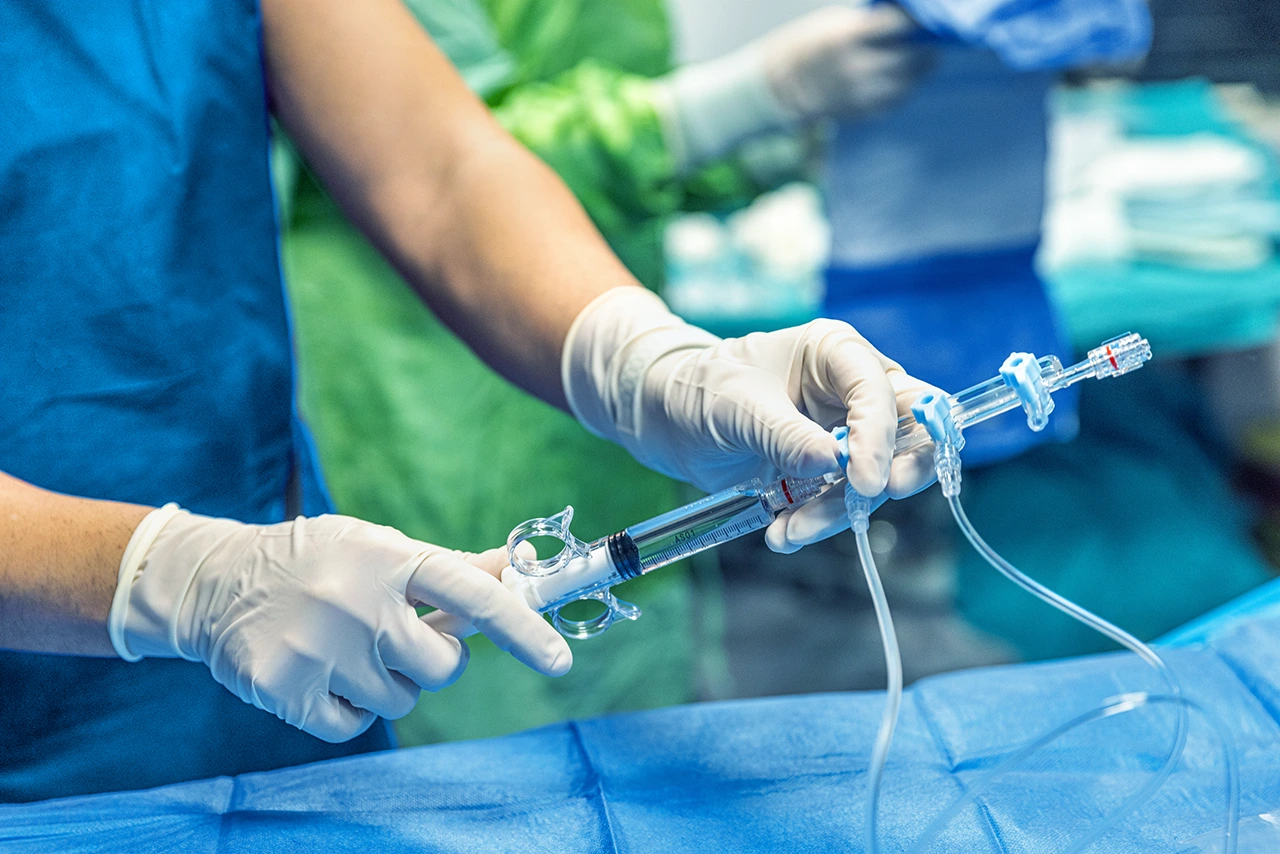Peritoneal dialysis | ABC Medical Center